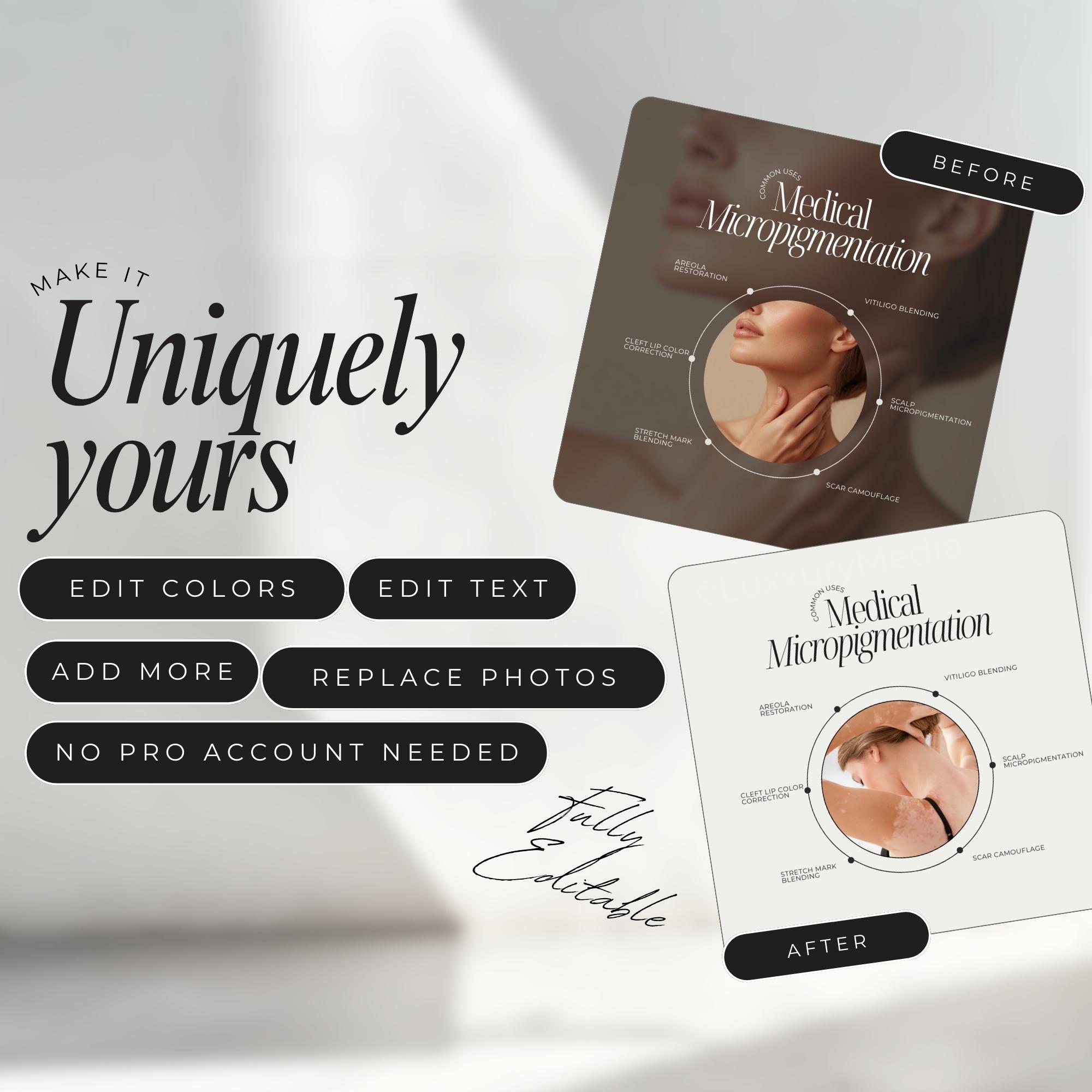 Paramedical Tattoo Instagram Templates | Scar Camouflage Posts ...