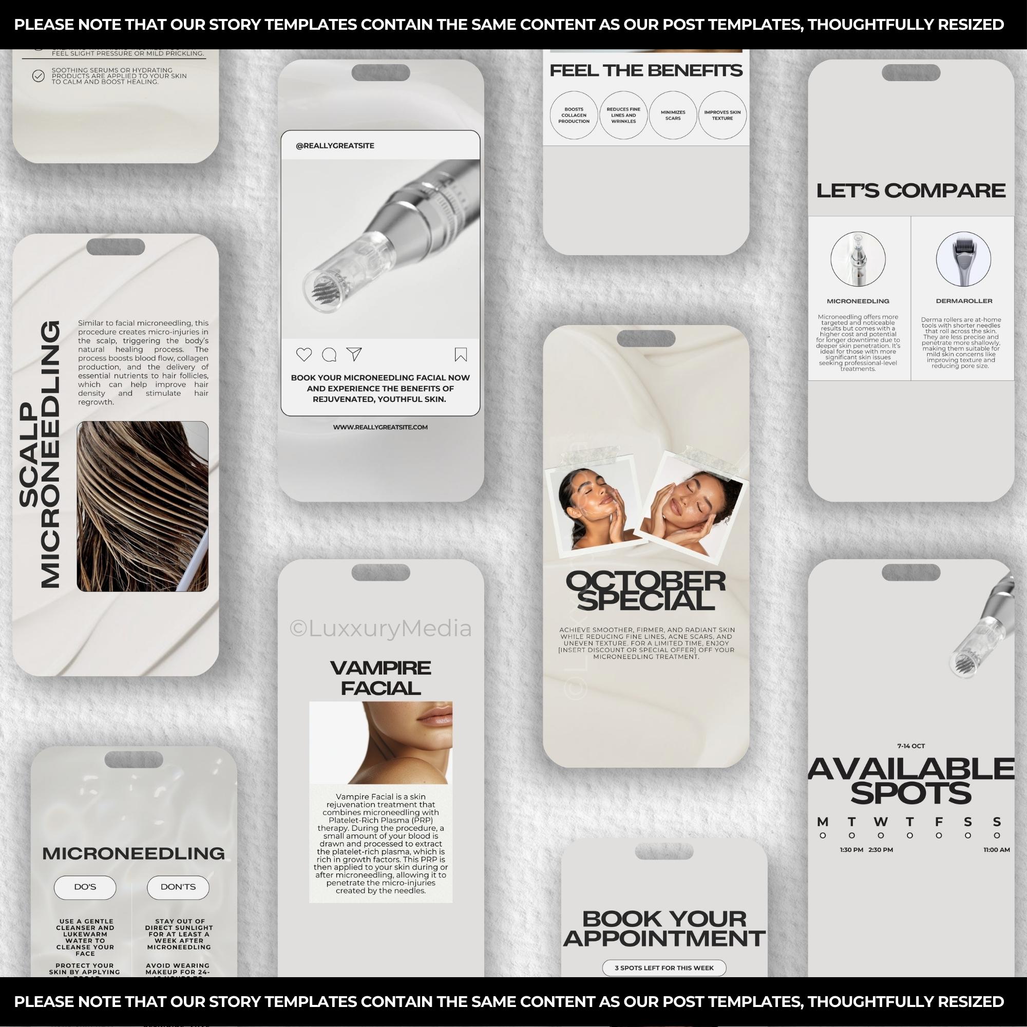 Microneedling Instagram Templates | RF Microneedling Posts | Medspa ...