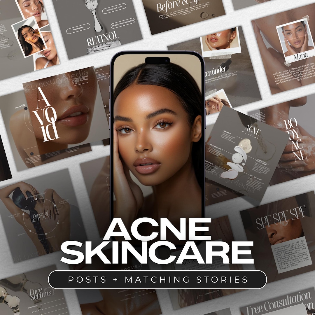 Luxury Skincare Instagram Templates | Esthetician Social Media Posts ...