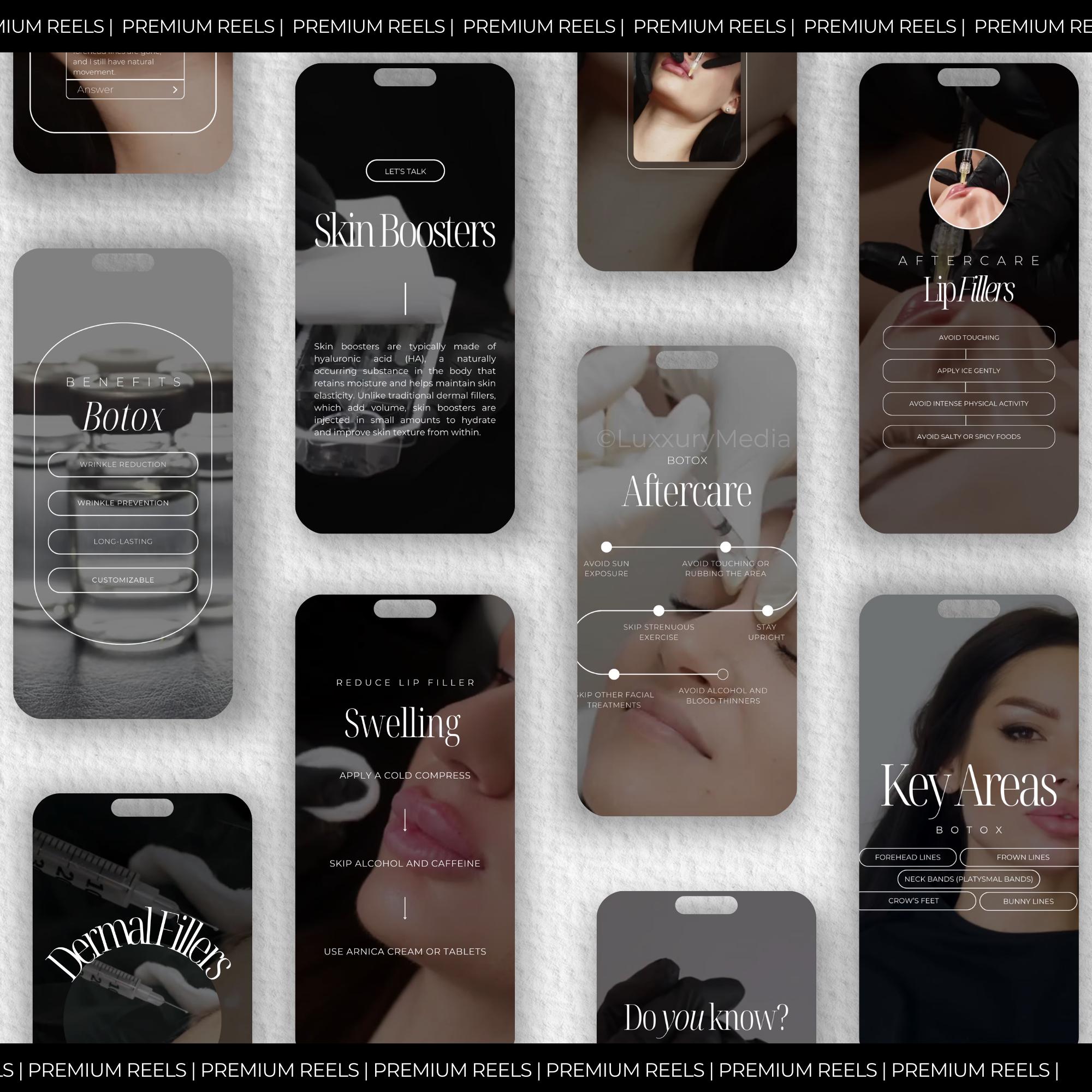 Lip Filler & Botox Instagram Reels Nurse Injector Reels Medspa Video ...