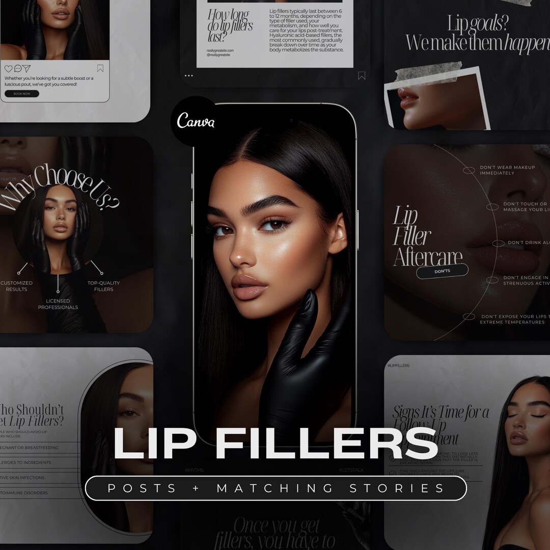 Lip Filler Templates | Nurse Injector Social Media Posts | Aesthetic ...