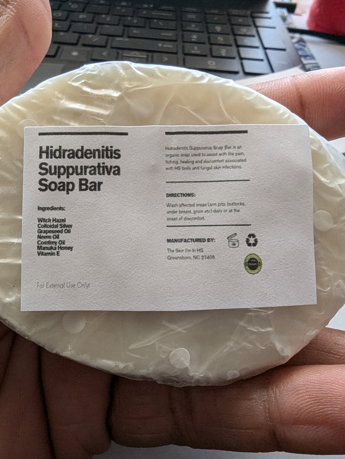 Hidradenitis Suppurativa Soap - Etsy