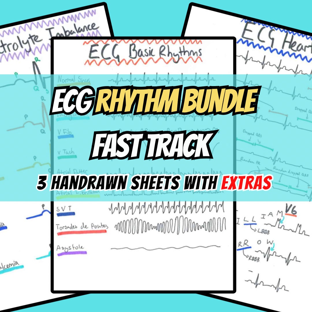 ECG Rhythms Bundle - Etsy