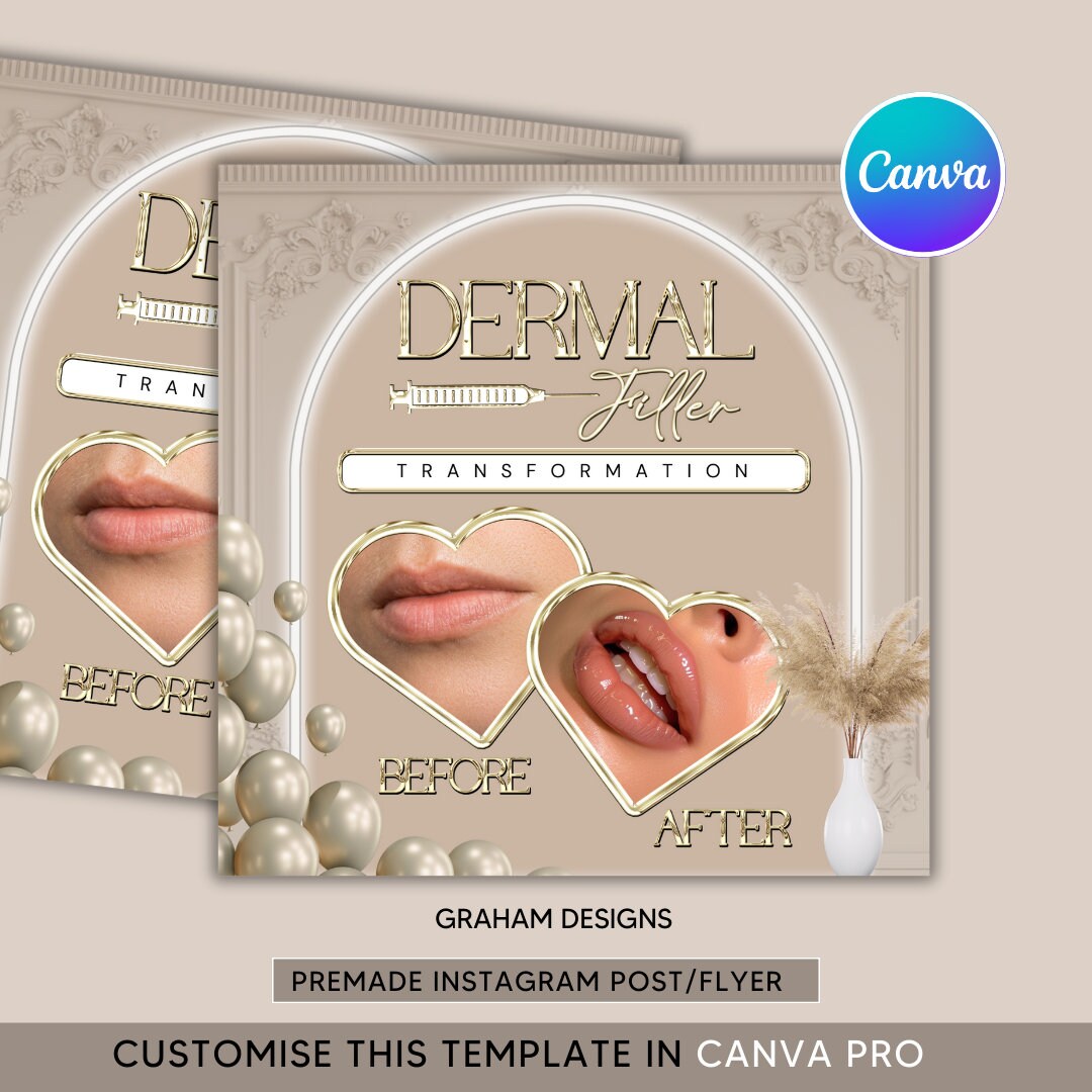 Dermal Filler Transformation Post, Aesthetics Post, Aesthetic ...