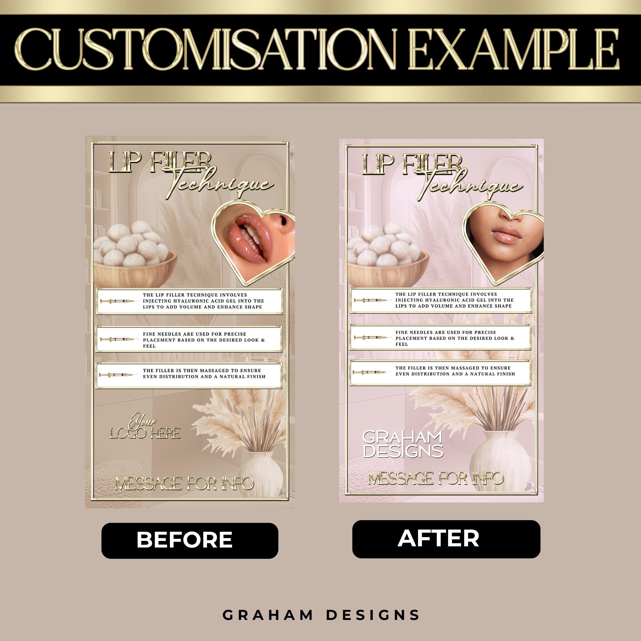 20 X Lip Filler Instagram Posts, Beige and Gold, for IG Story & Reel ...