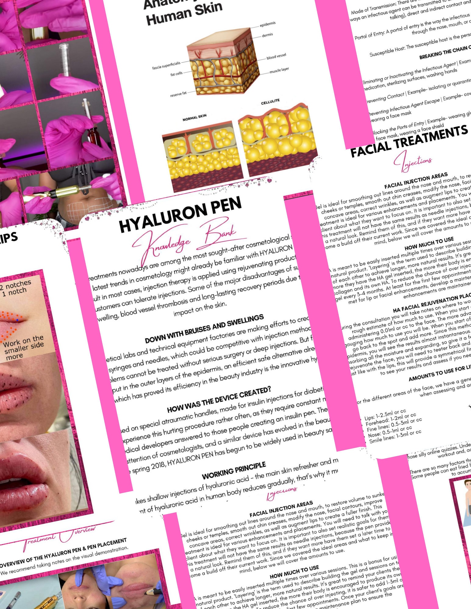 Hyaluron Pen Training Manual: Fat Dissolve & Fillers (canva Editable ...