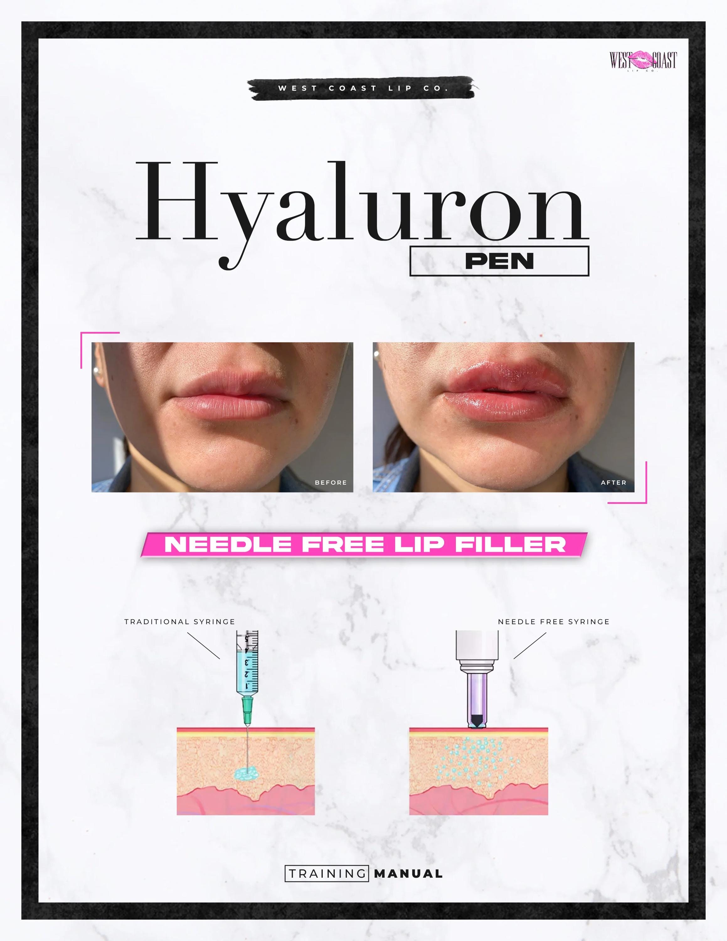 Hyaluron Pen Training Manual: Fat Dissolve & Fillers (canva Editable ...