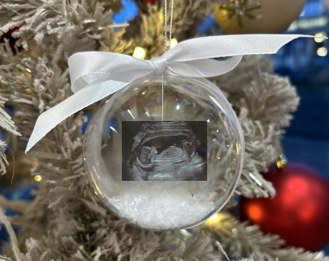 Personalised Pregnancy Scan Photo Bauble, Christmas Tree Decorations - Etsy