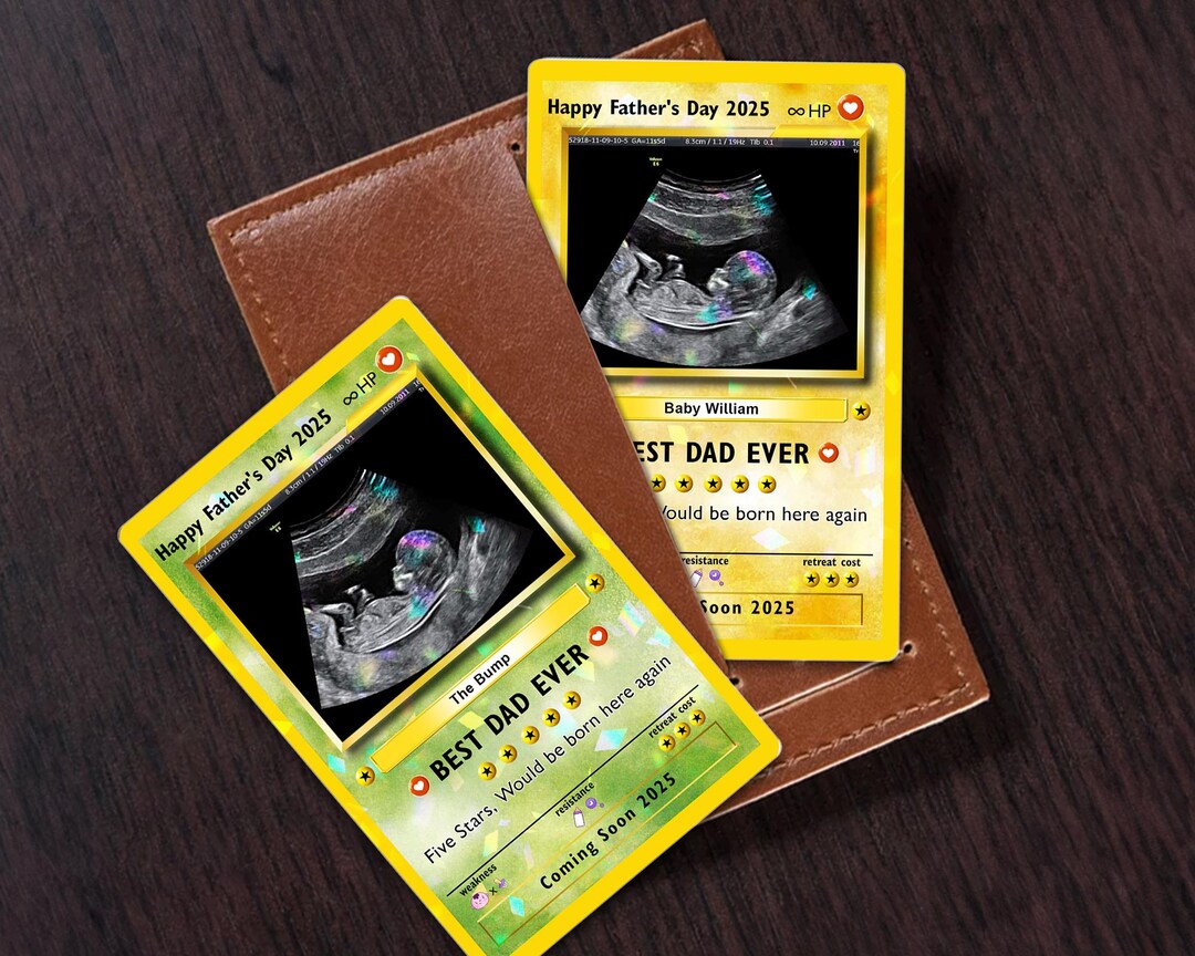 Custom Ultrasound Photo Wallet Card, New Baby Sonogram Gift, Baby ...