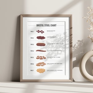 The Bristol Stool Chart | Lab Wall Art | Laboratory Specialist | A ...