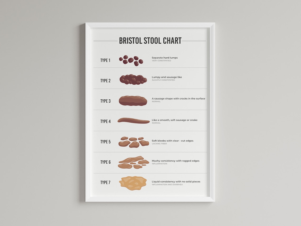 The Bristol Stool Chart | Lab Wall Art | Laboratory Specialist | A ...
