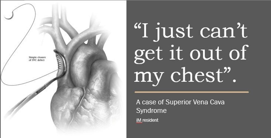 Superior Vena Cava Medical Template Grand Rounds Scientific - Etsy