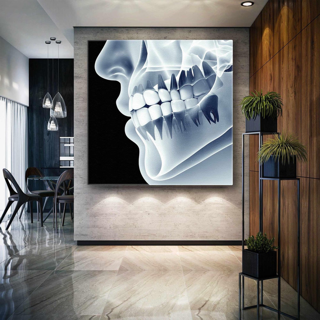 Dental Health Wall Art, Jaw X-ray Canvas Art, Dentist Wall Decor, Roll ...