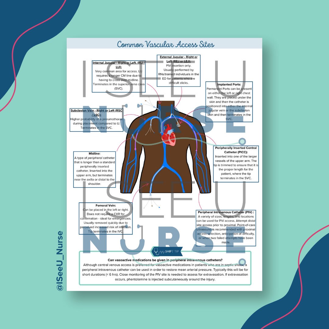 Common Vascular Access Resource for Nurses - Etsy