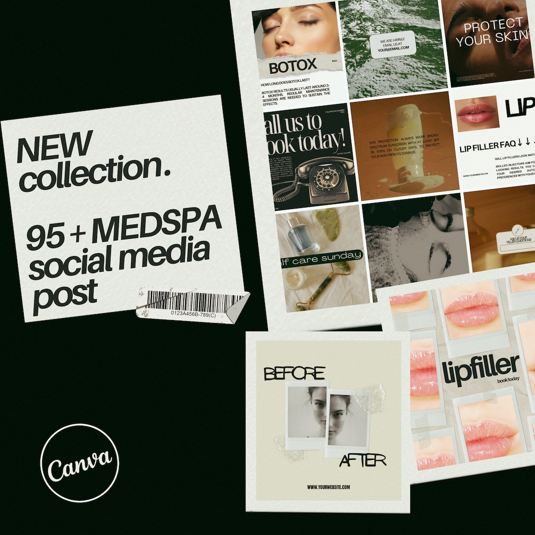Botox Filler Templates / Skincare Templates / Botox Instagram / Nurse ...