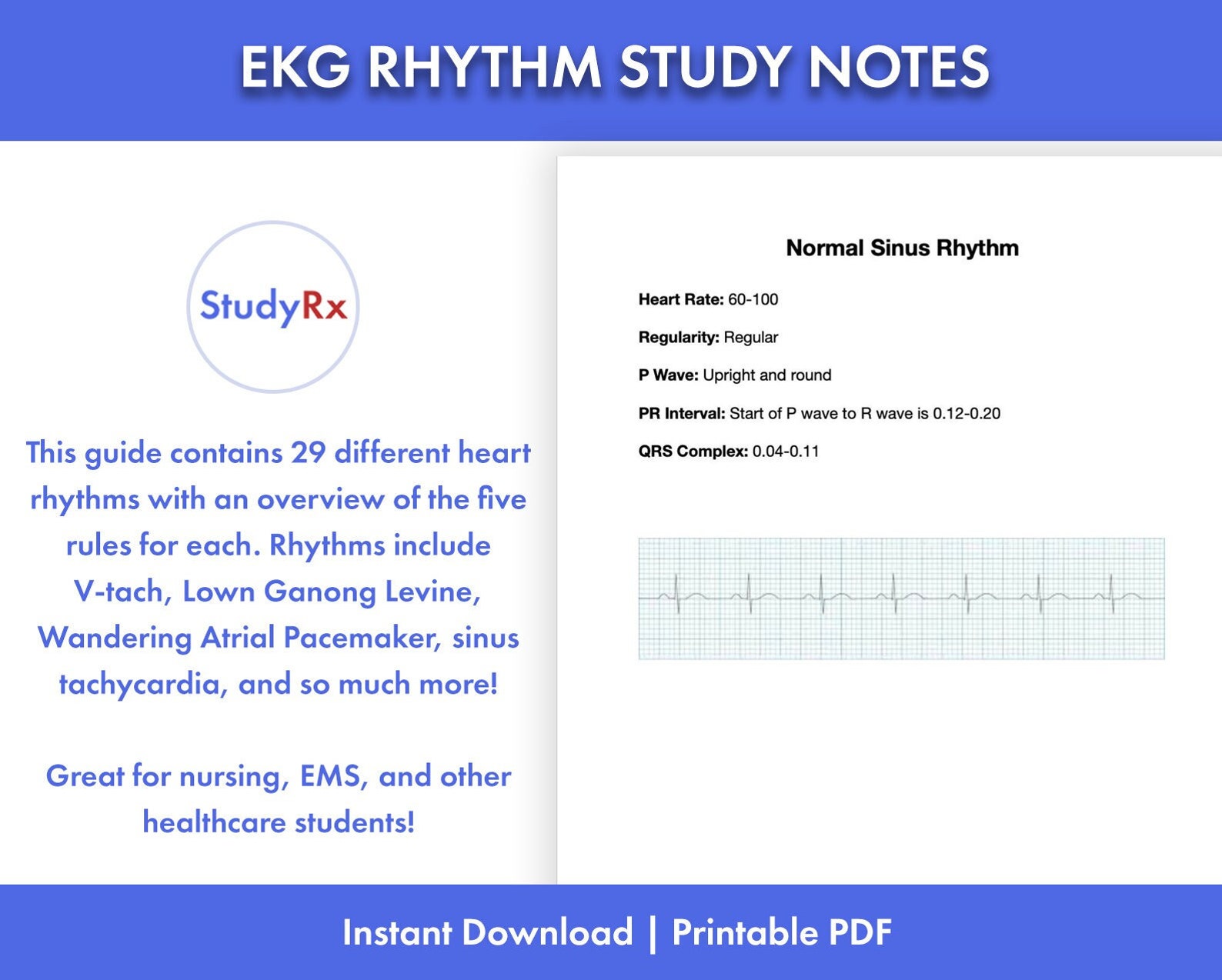 EKG Rhythm Notes Paramedic Nursing Study Guide Med School NCLEX EMT - Etsy