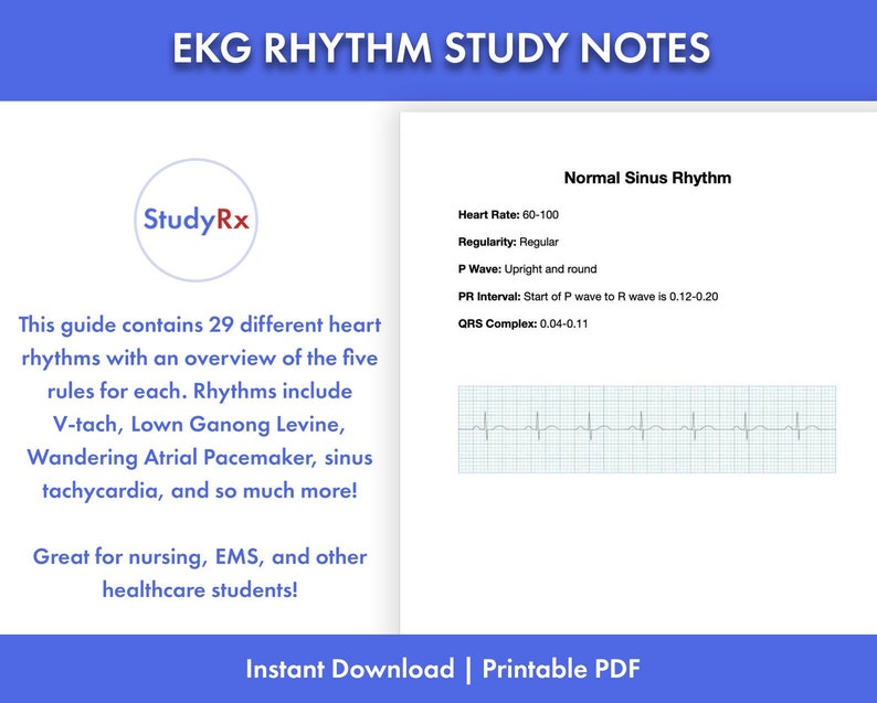 EKG Rhythm Notes| Paramedic | Nursing Study Guide | Med School | NCLEX ...