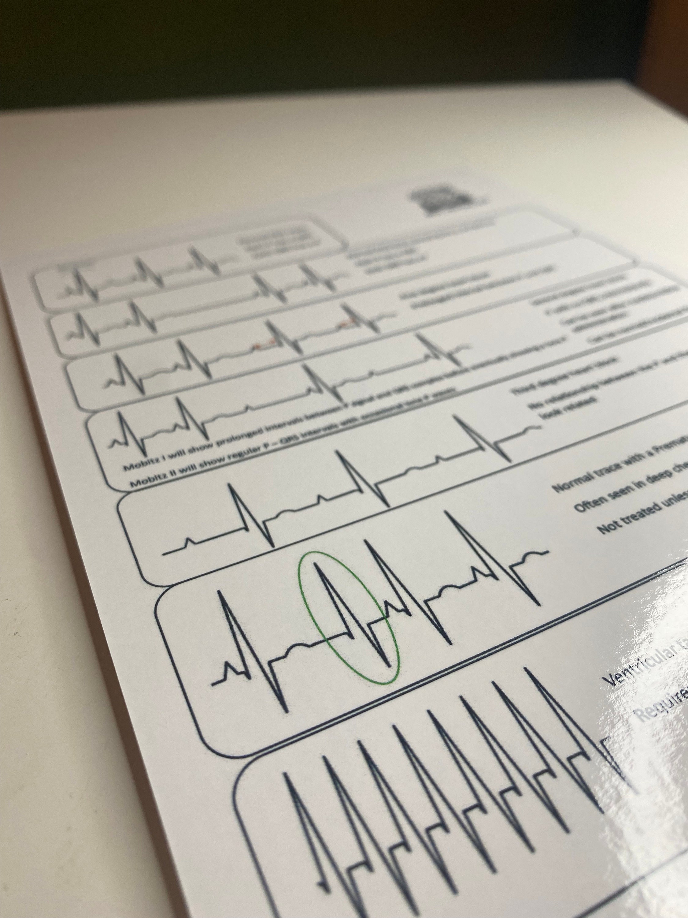 Ecg/capnography Reference Card - Etsy