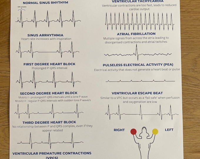A3 ECG Poster - Etsy