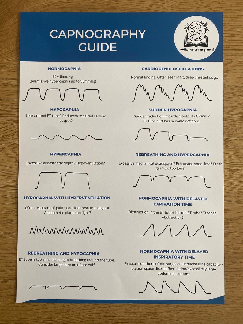 A3 Capnography Poster - Etsy