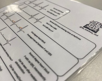 ECG/EKG Fast Fact Cheat Sheet Card - Etsy