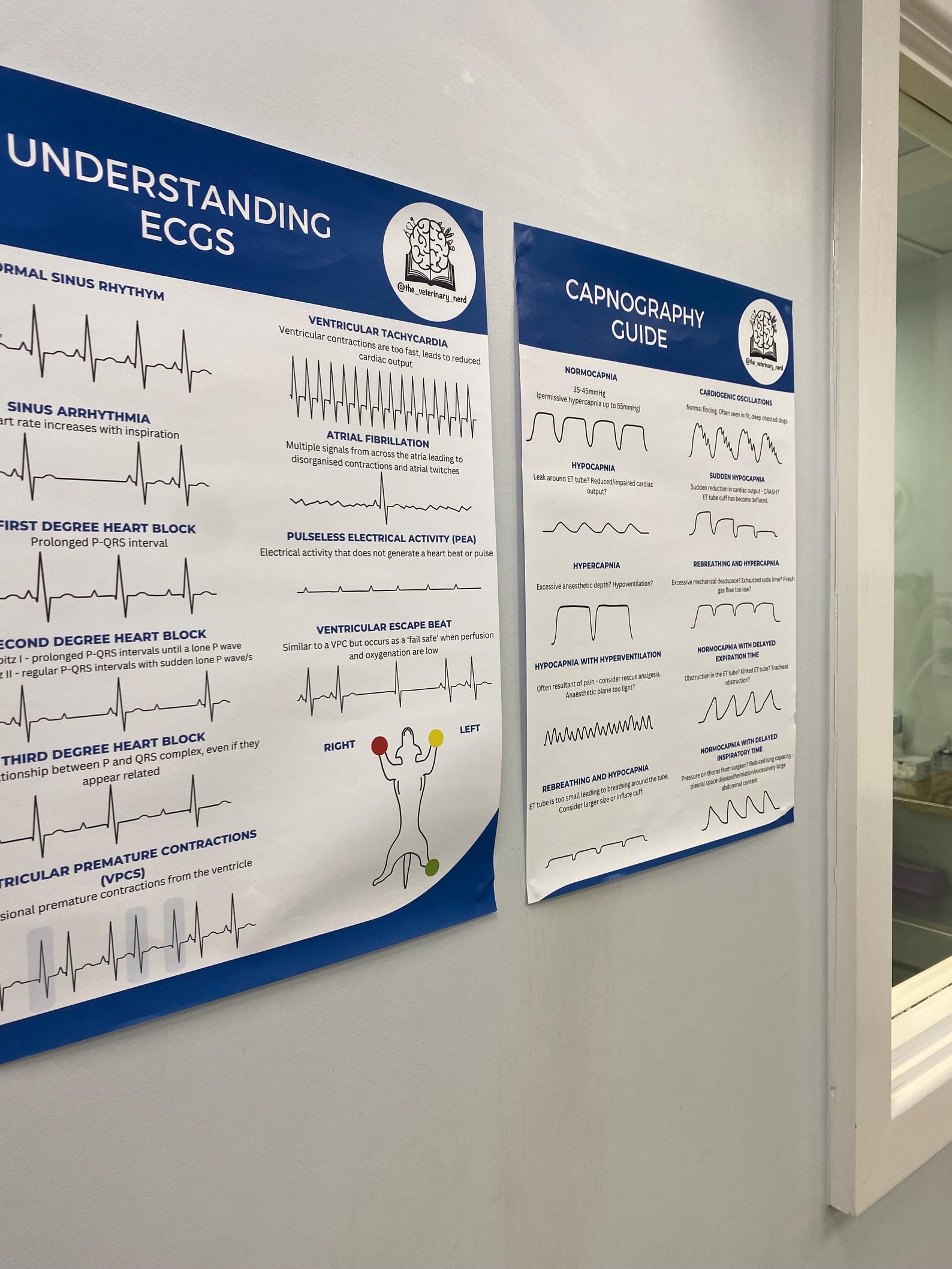 A3 ECG Poster - Etsy