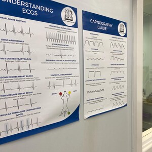 A3 ECG Poster - Etsy