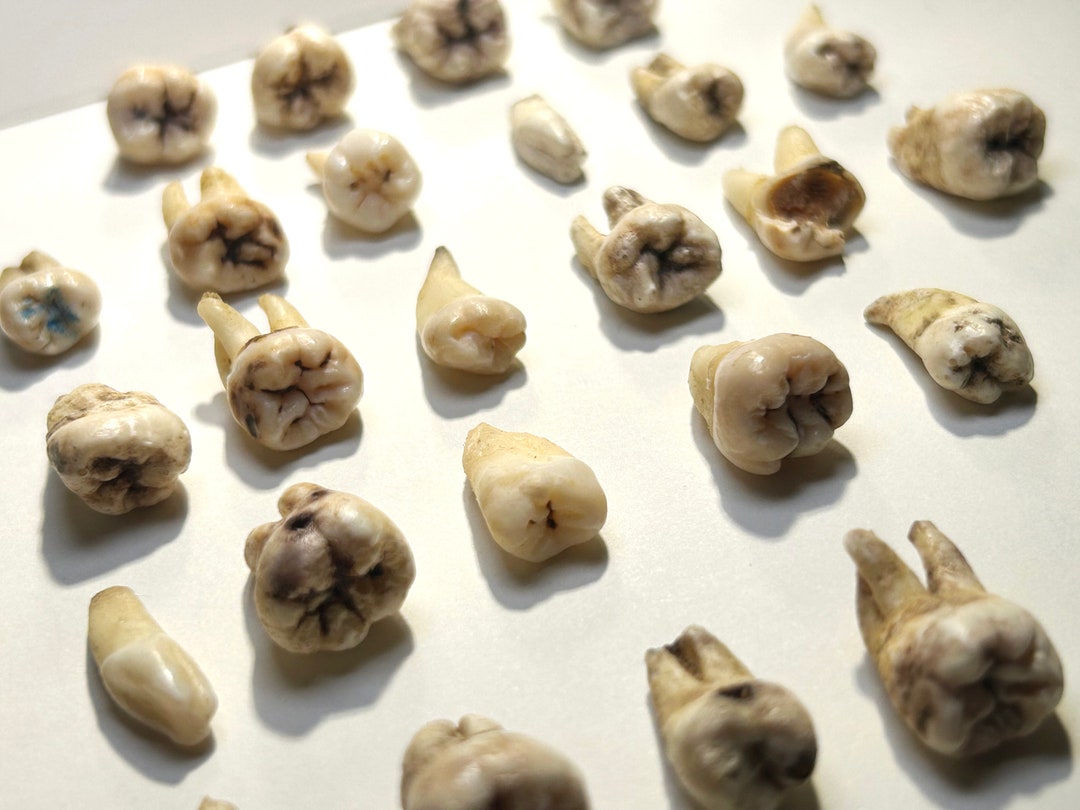 Realistic Human Teeth Resin Replicas for SFX , Oddities , Jewelry ,film ...