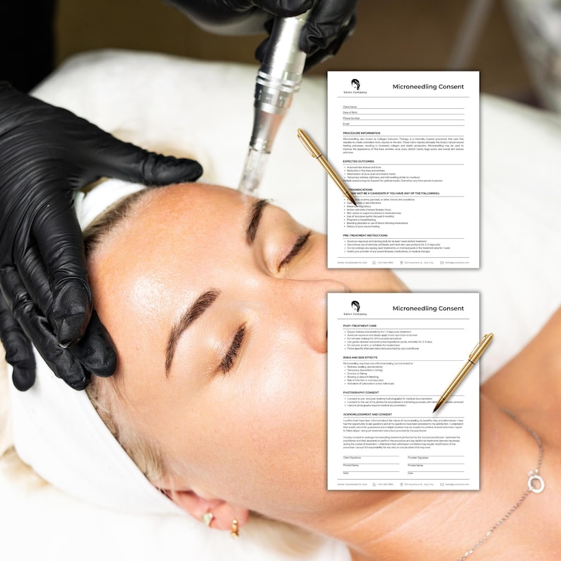Microneedling Consent Form, Dermal Needling, Cosmetologist Forms ...