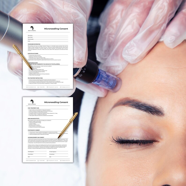 Microneedling Consent Form, Dermal Needling, Cosmetologist Forms ...