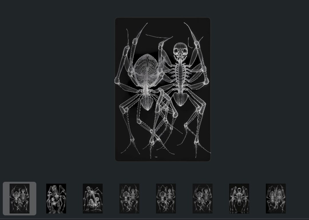 Xray Human Skeleton Spider Art Digital Art Printable Wall Art Teens ...