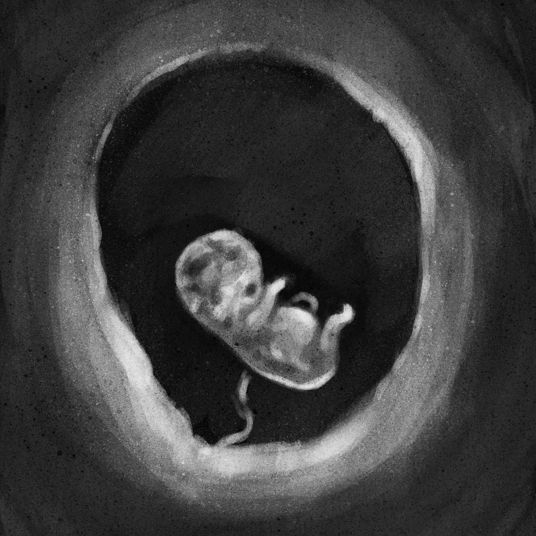 Infant Loss Ultrasound Hand-drawn Sketch digital File - Etsy