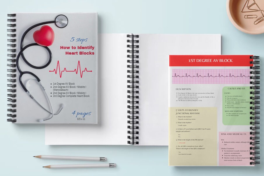 5-steps How to Identify Heart Blocks Cheat Sheet - Etsy