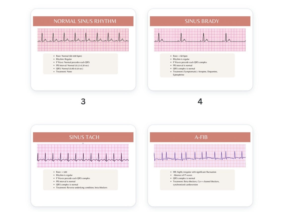 EKG Interpretation 4x6 Flashcards Printable - Etsy EKG Interpretation 4x6 Flashcards Printable - Etsy