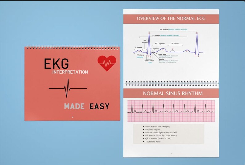 EKG Interpretation 4x6 Flashcards Printable - Etsy