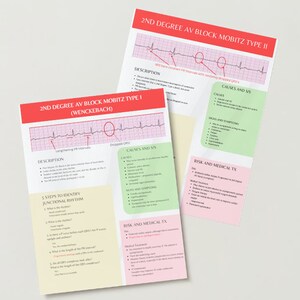 5-steps How to Identify Heart Blocks Cheat Sheet - Etsy