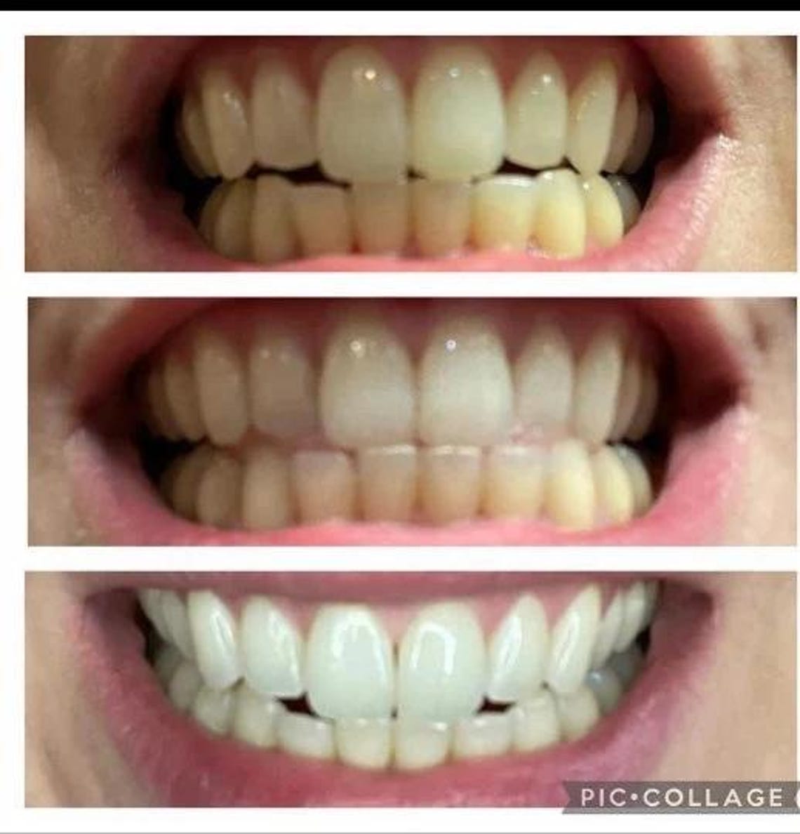 Whitening Fluoride Toothpaste - Etsy