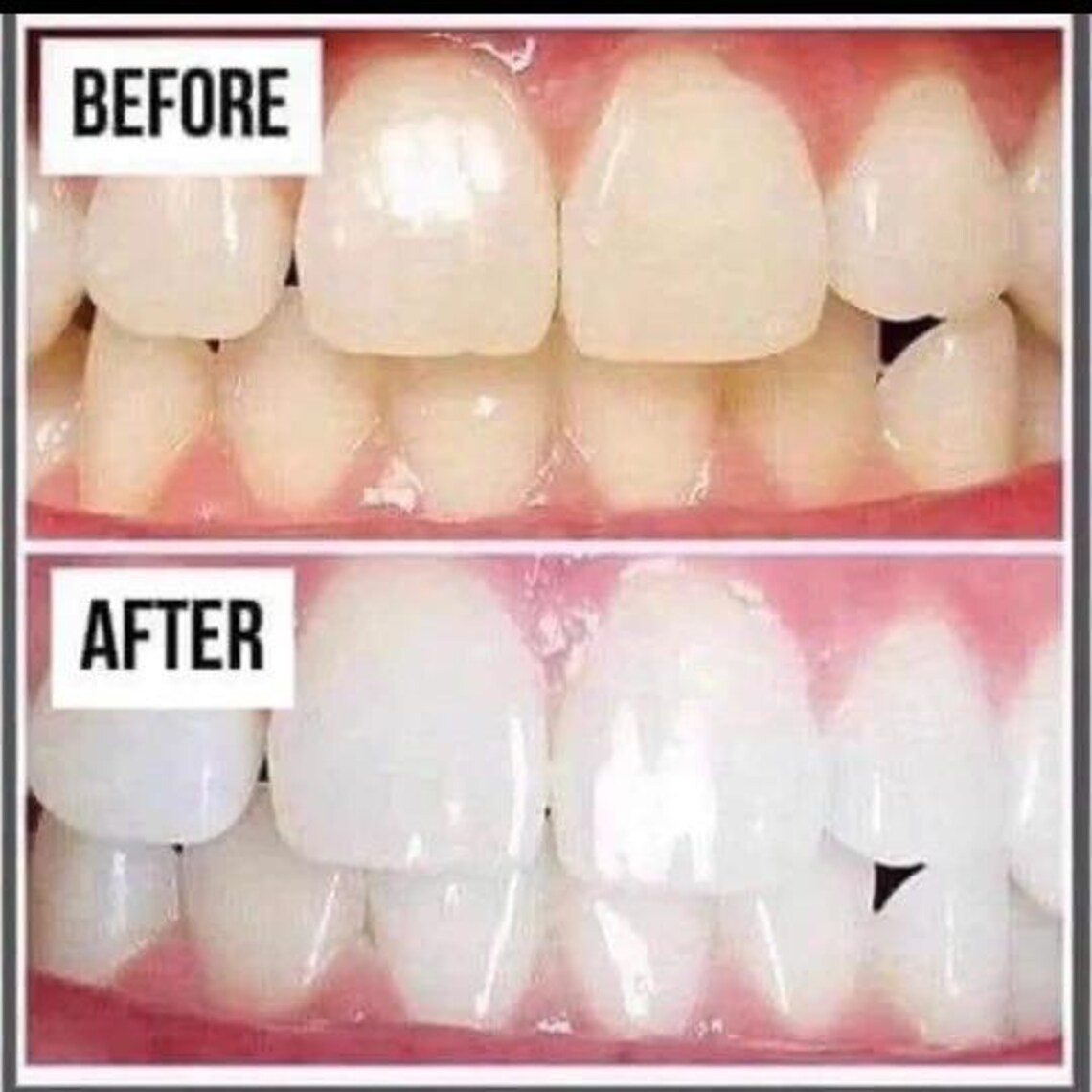 Whitening Fluoride Toothpaste - Etsy