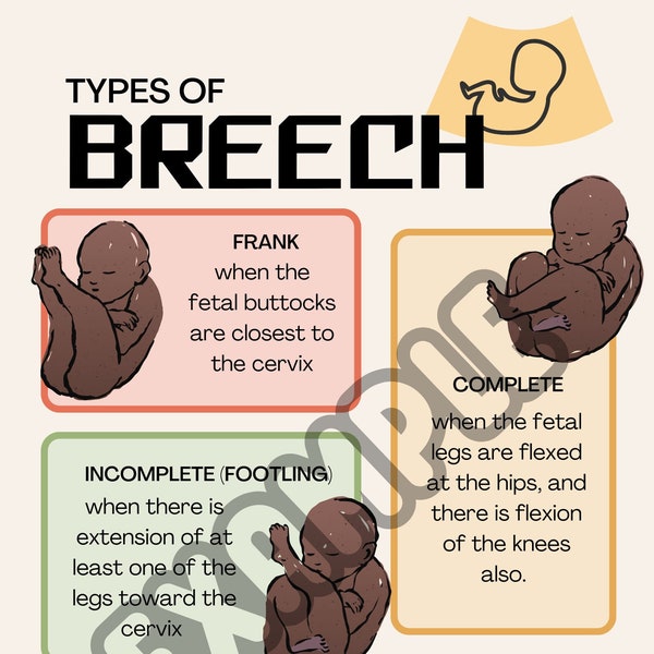 Breech - Etsy