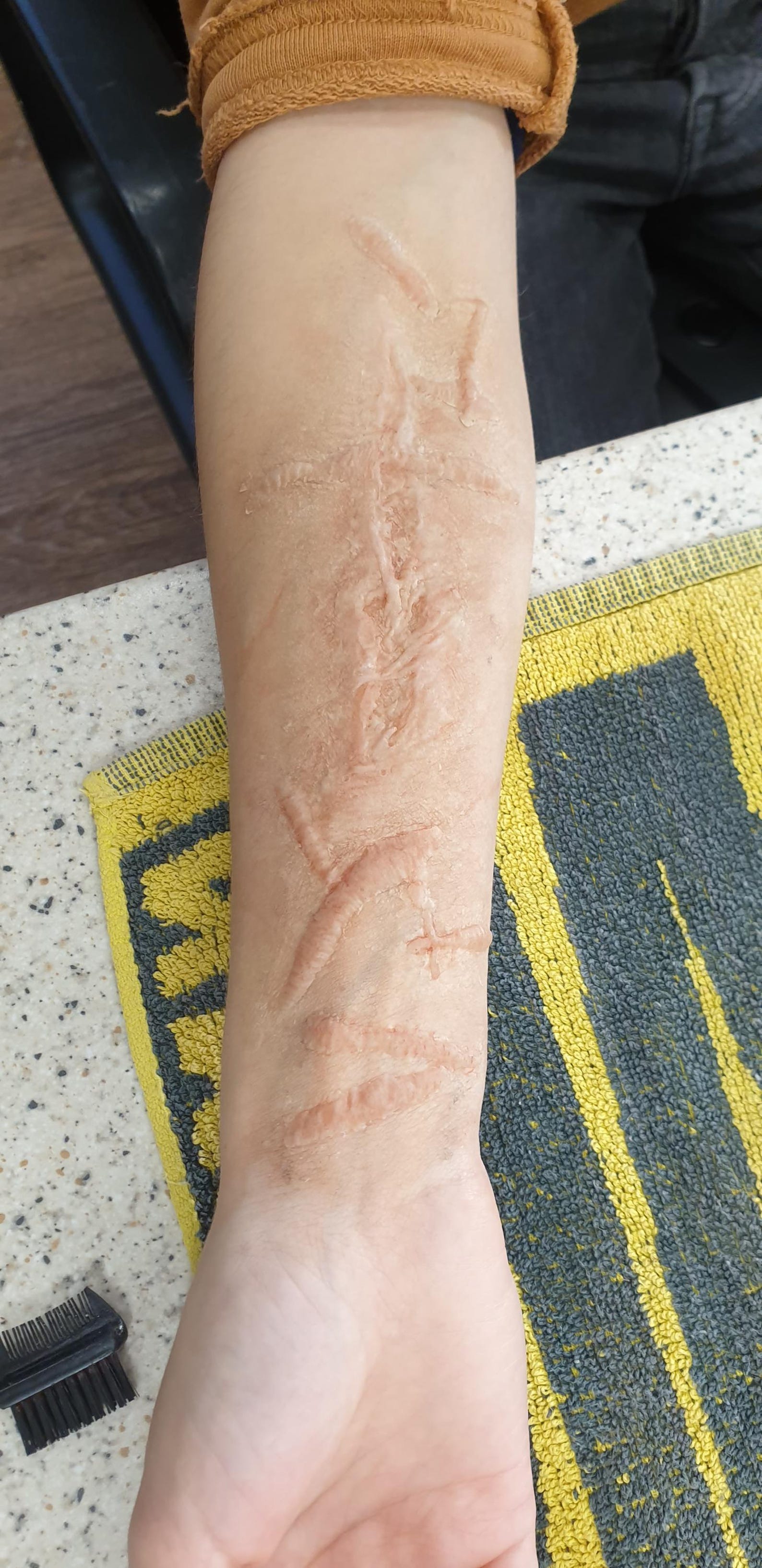 Self Harm Scar Prosthetic – Silicone SFX Scar – Film Makeup Appliance ...