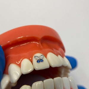 Butterfly Tooth Gem Crystal Design, Tooth Gem Kits, Tooth Jewelry - Etsy