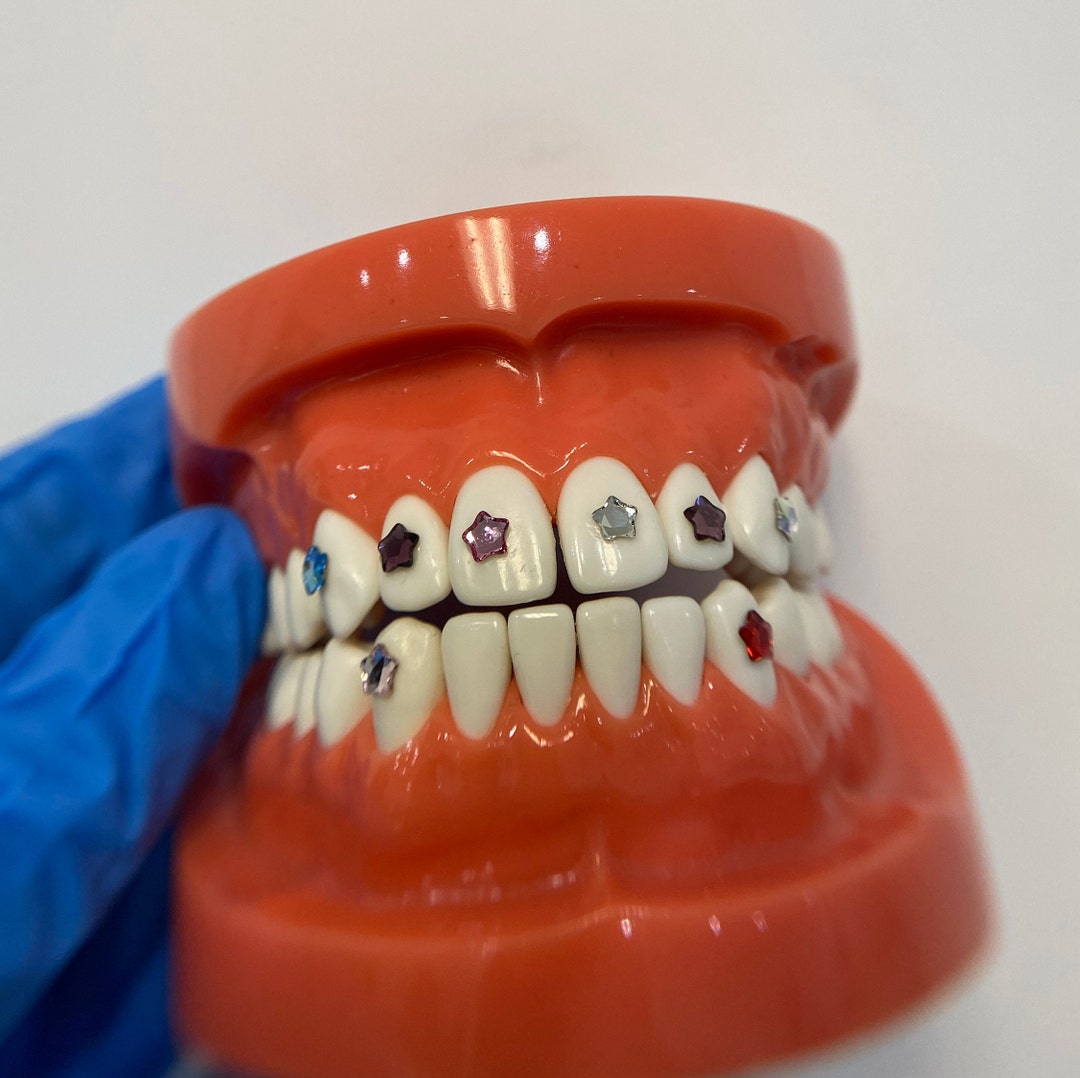 Star Tooth Gem Crystal Design, Tooth Gem Kits, Tooth Jewelry - Etsy