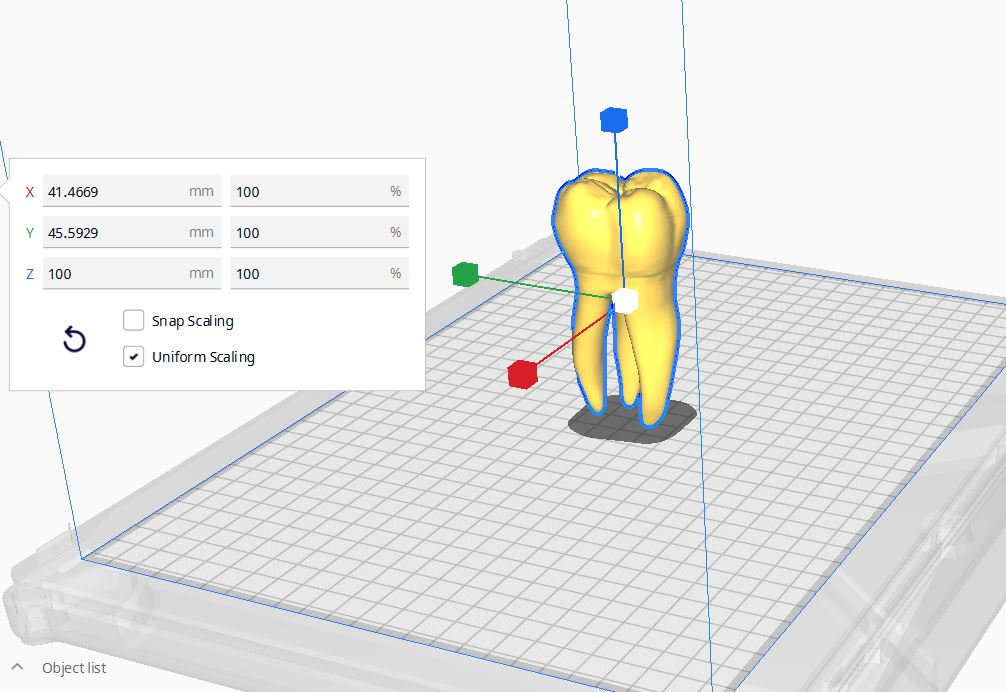 3D Printing Molar Tooth Model Real Human Tooth STL File - Etsy