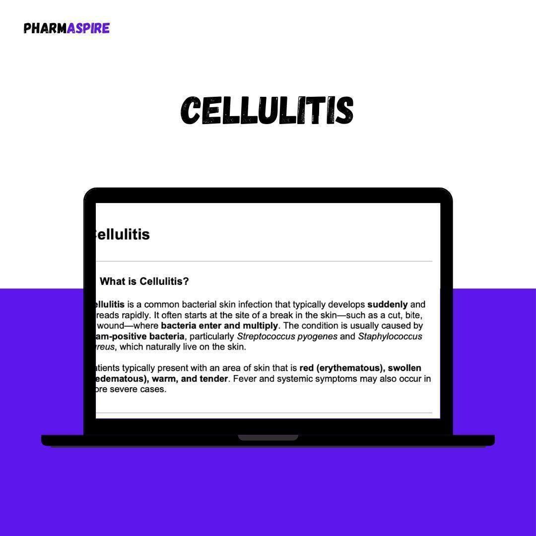 Cellulitis Study Guide: Diagnosis, Treatment, and Management - Etsy ...