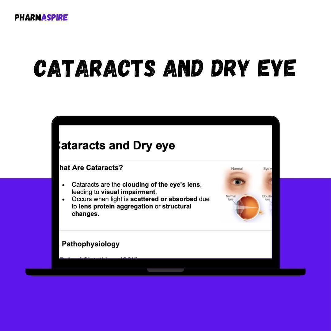 Cataracts and Dry Eye Disease (DED) Study Guide: Diagnosis, Treatment ...