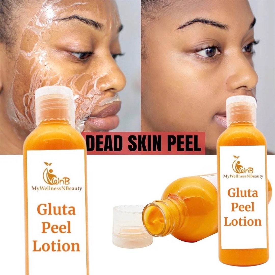 Peeling Lotion. Dark Elbow Peeling. Dark Hand Peeling. Dark - Etsy