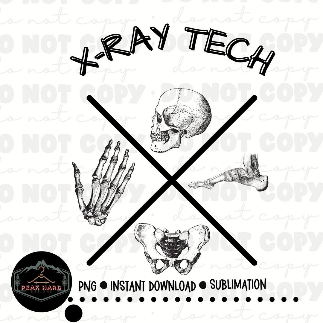 Xray Tech PNG Digital File Instant Download. Bones Png. Radiology PNG ...
