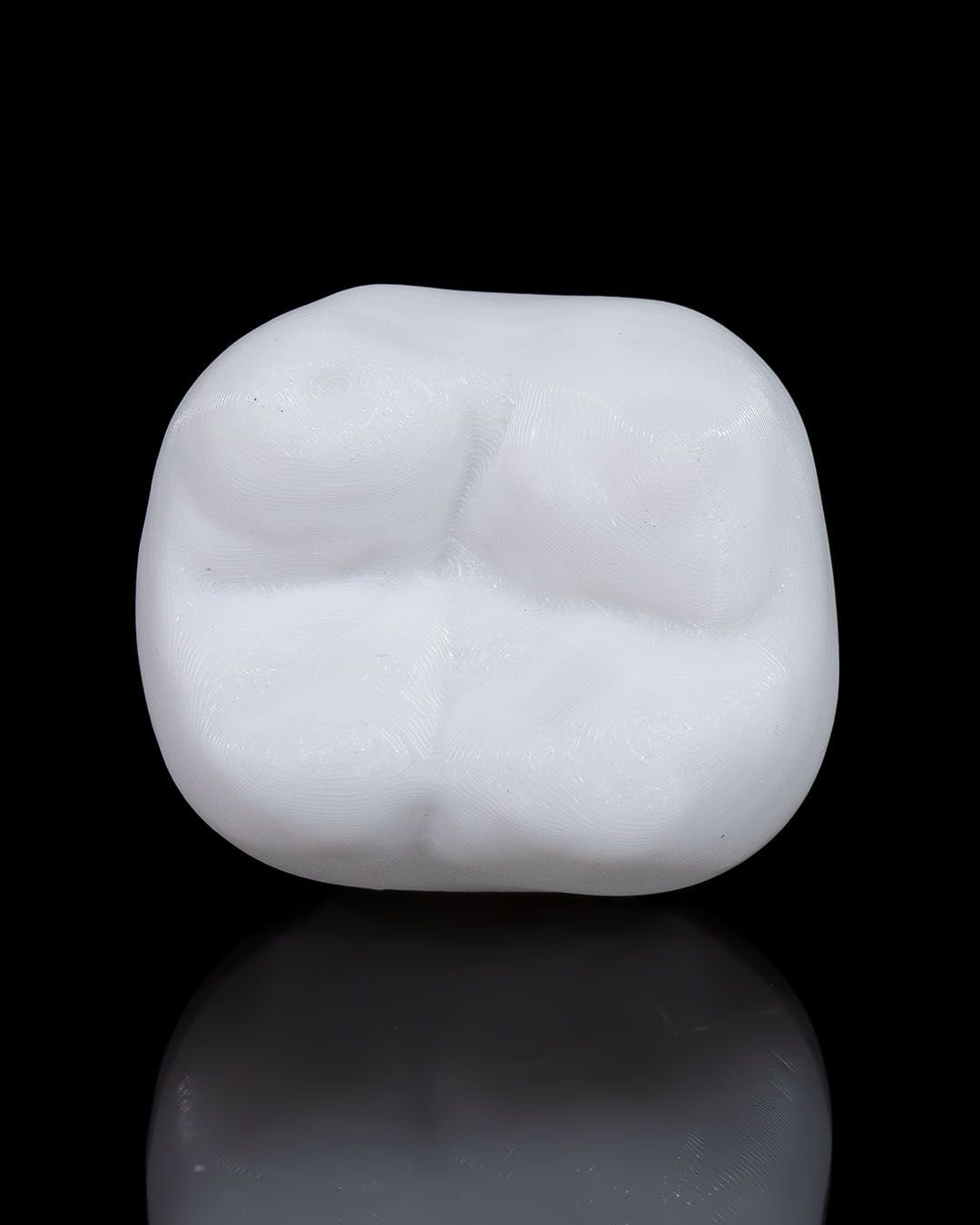 Detailed 3D Printed Dental Implant Model - Etsy