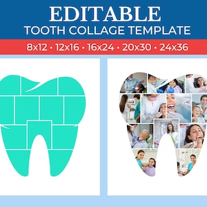 Dentist Gift | Picture Collage Tooth Template | Gridart | Image Collage ...