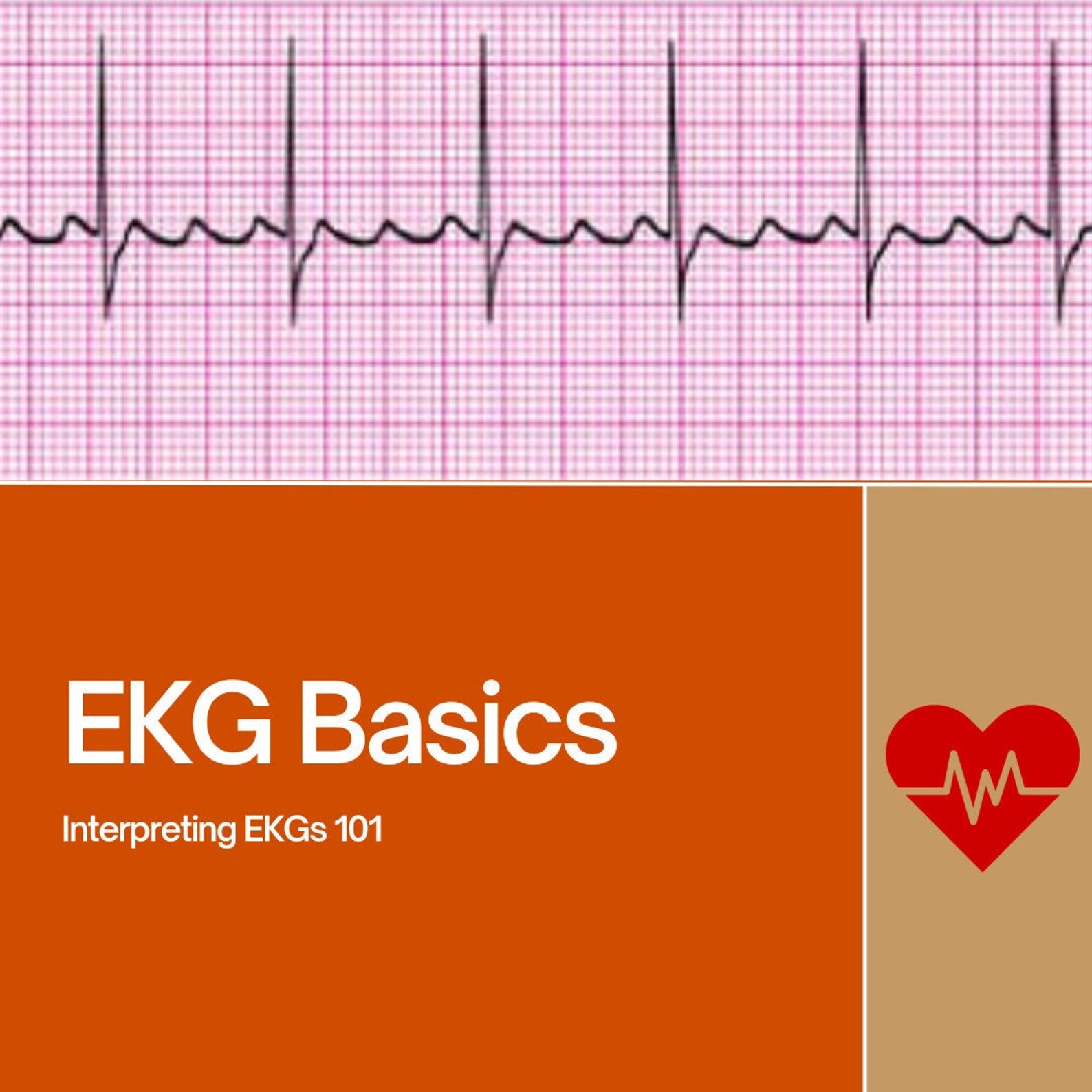 EKG Basics - Etsy